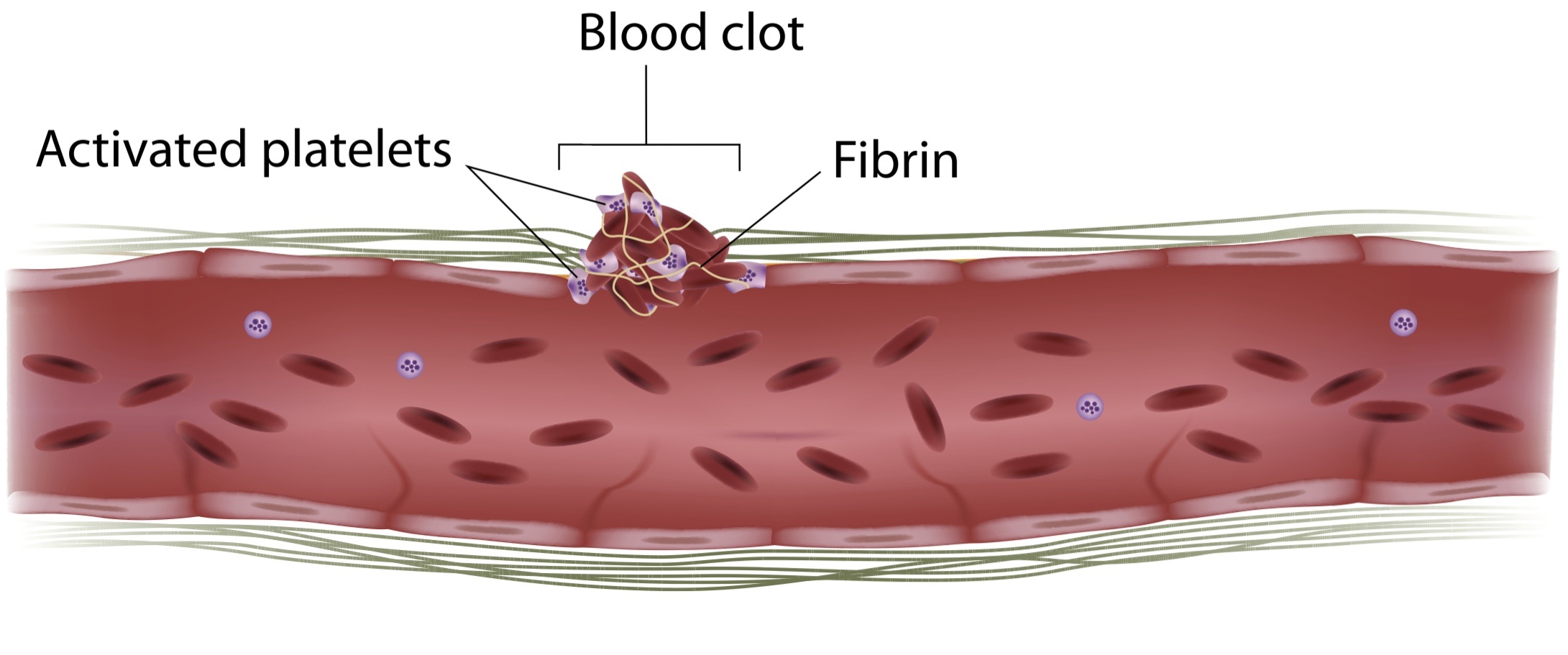 Coagulation Factors Blood Test