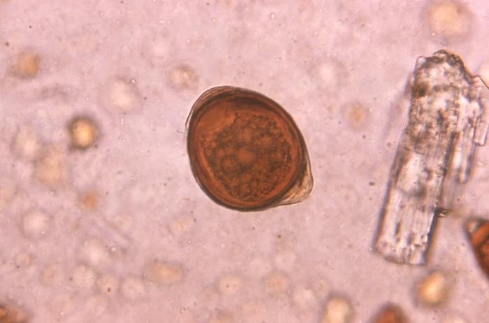 Facts about Whipworm Infection