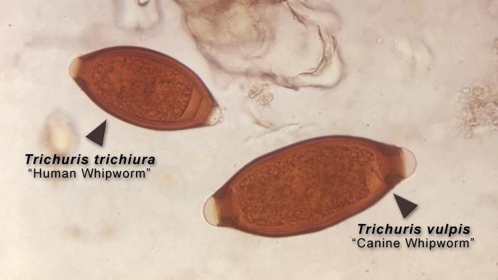Whipworm Infection