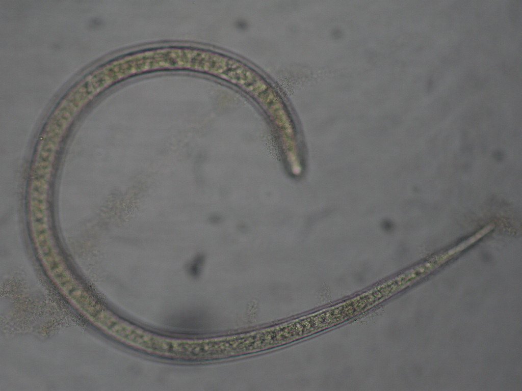 Trichinosis Infection