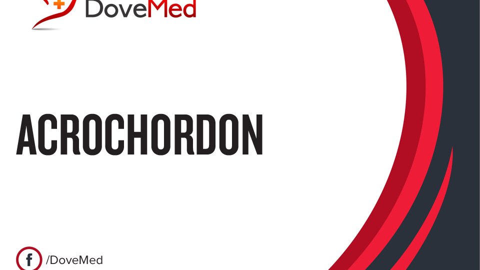 Acrochordon