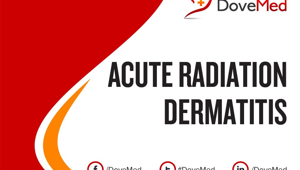 Acute Radiation Dermatitis