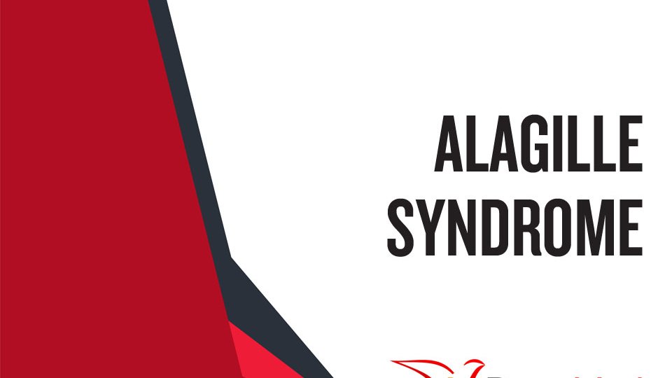 Alagille Syndrome