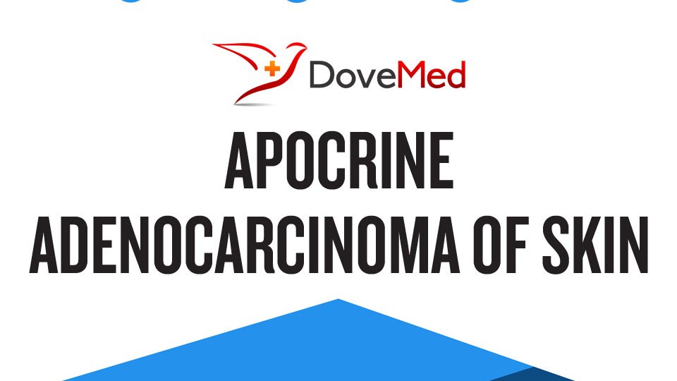 Apocrine Adenocarcinoma of Skin