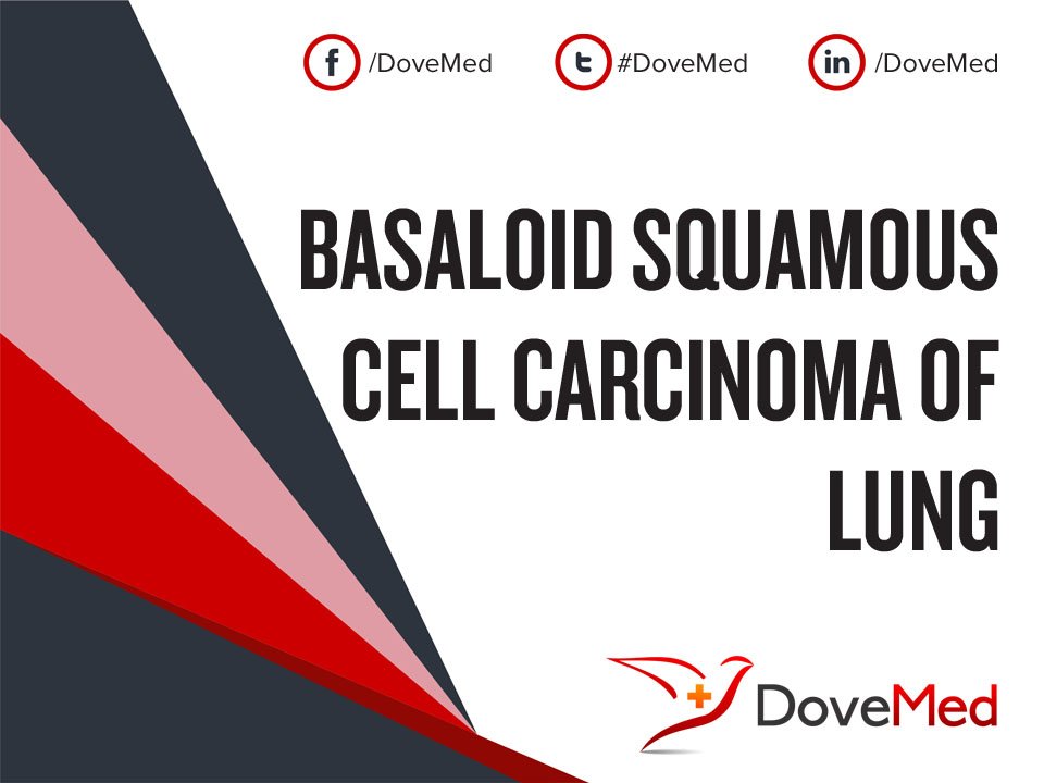Basaloid Squamous Cell Carcinoma of Lung