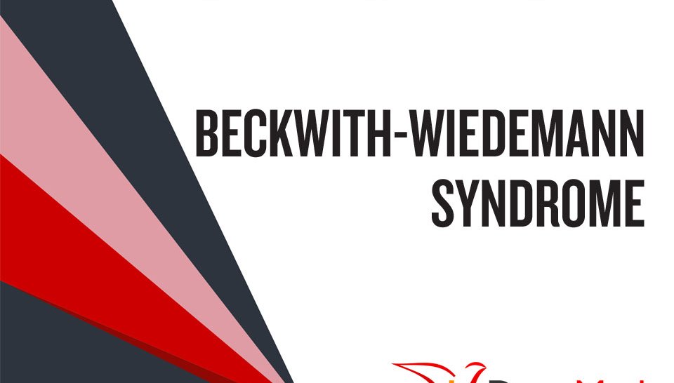 Beckwith-Wiedemann Syndrome (BWS)