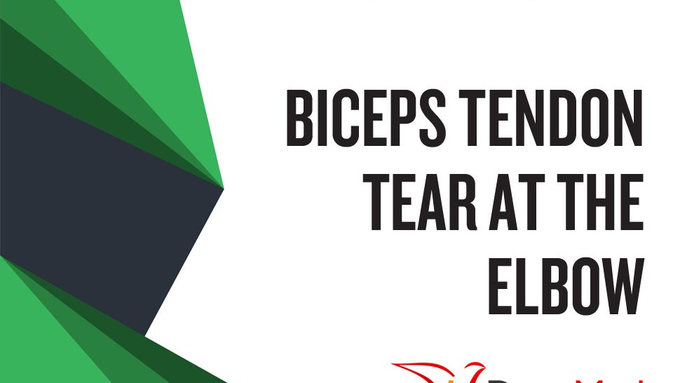 Biceps Tendon Tear at the Elbow