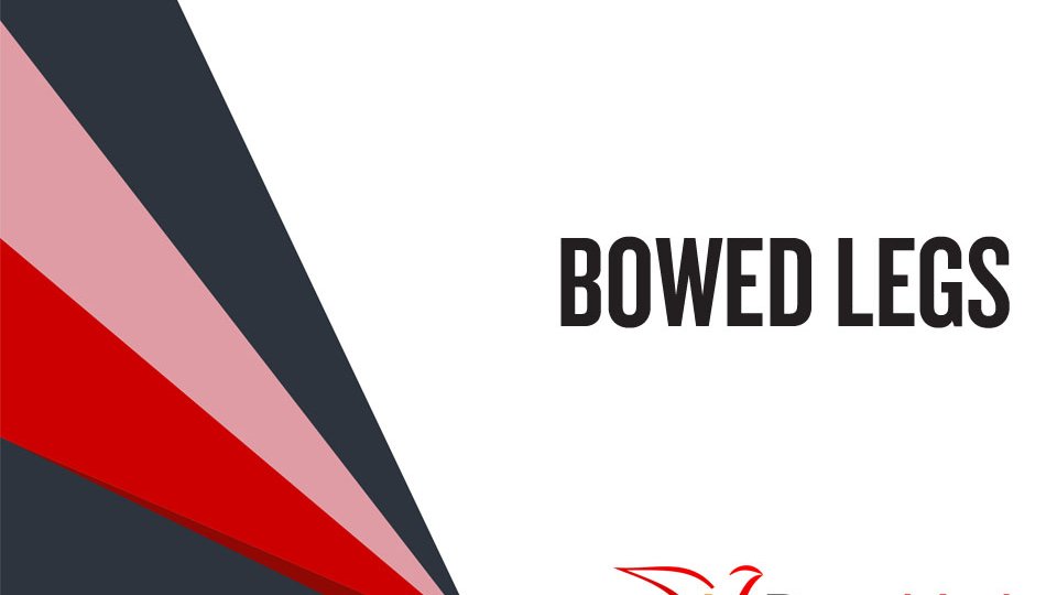 Bowed Legs