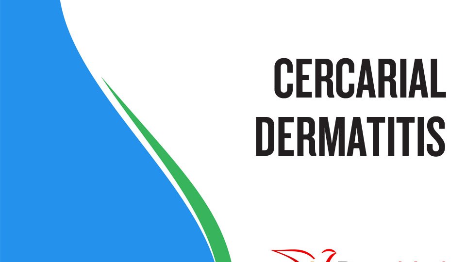 Cercarial Dermatitis