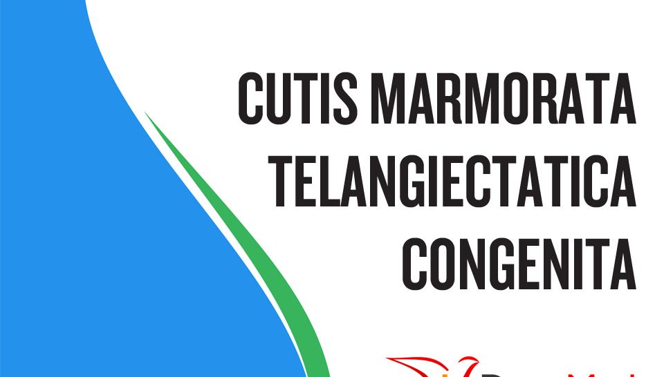 Cutis Marmorata Telangiectatica Congenita