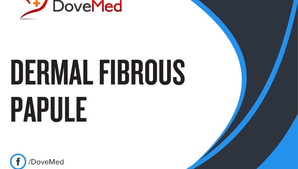 Dermal Fibrous Papule