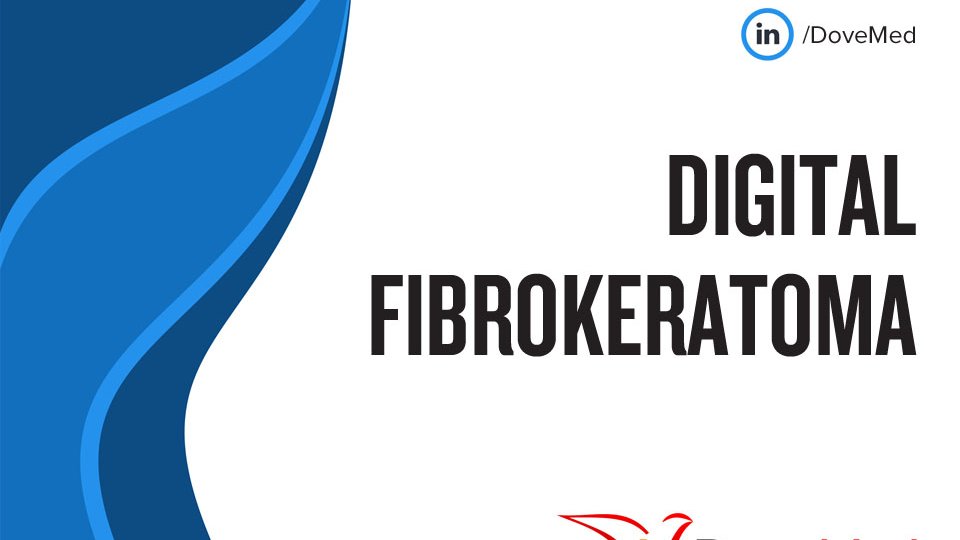 Digital Fibrokeratoma