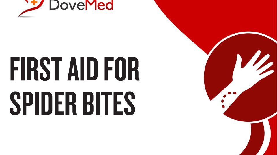 Wolf Spider Bites First Aid