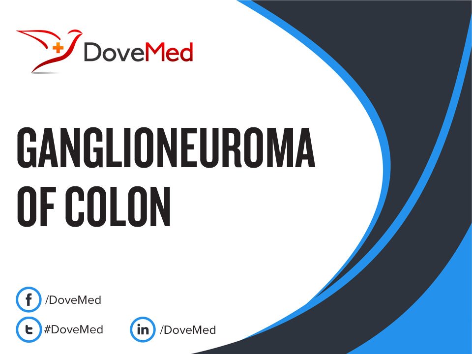 Ganglioneuroma of Colon