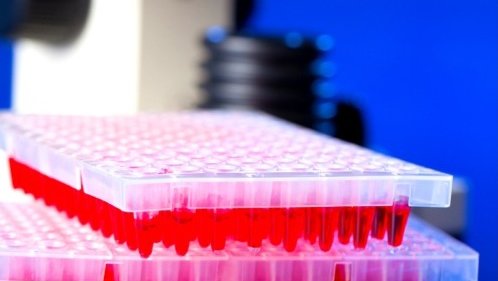 Gentamicin Trough Level Blood Test