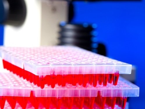 Gentamicin Trough Level Blood Test