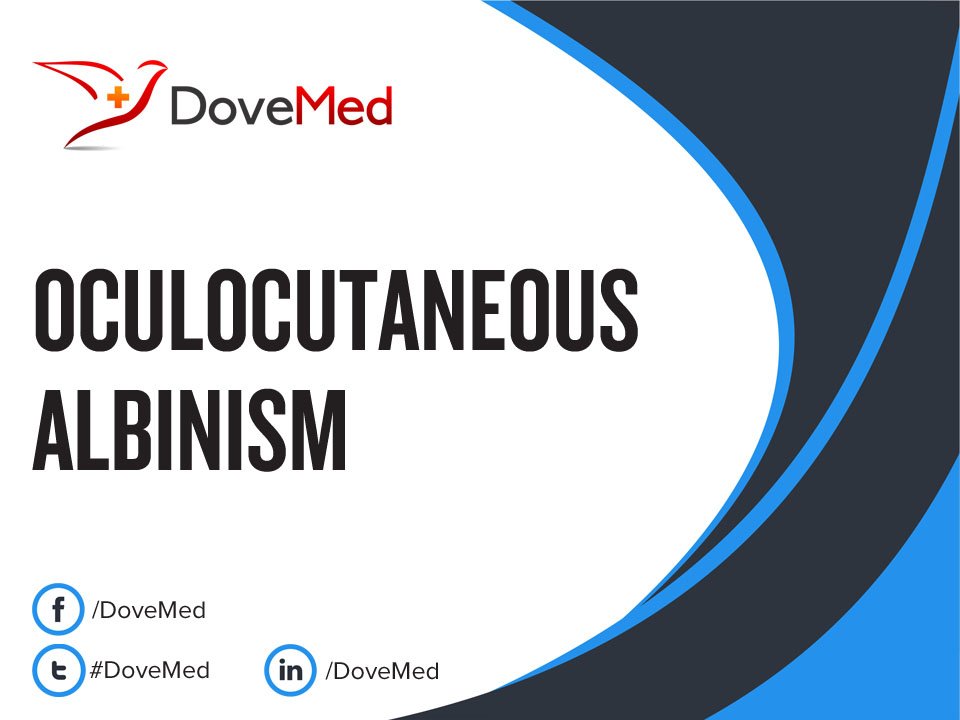 Oculocutaneous Albinism