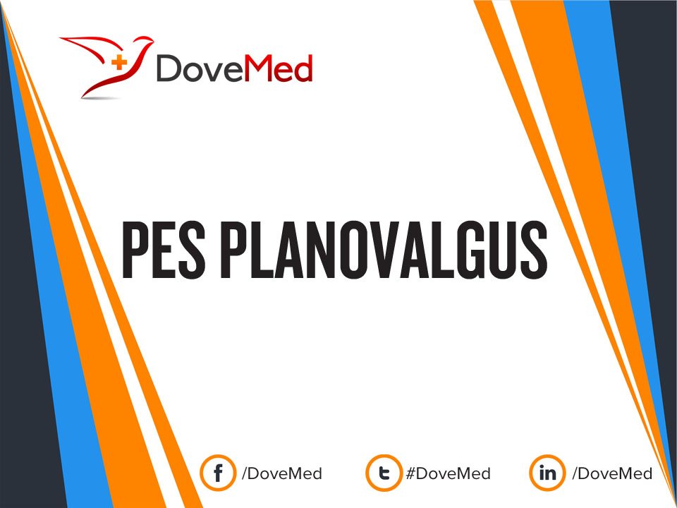 Pes Planovalgus