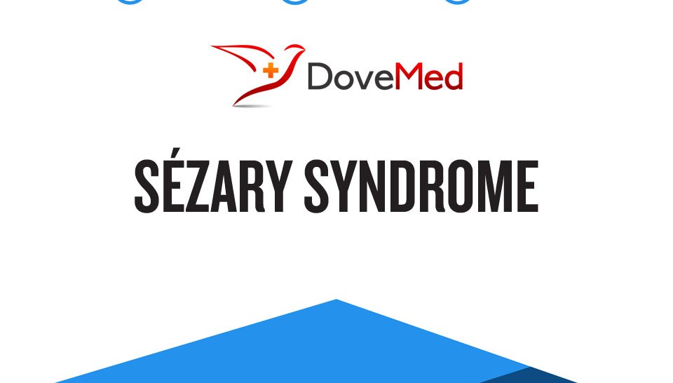 Sézary Syndrome