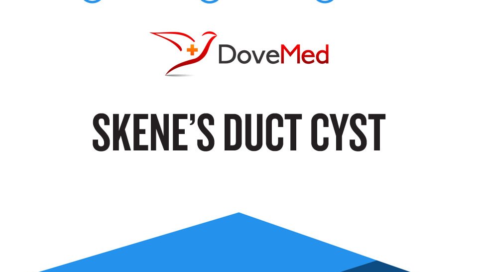 Skene's Duct Cyst