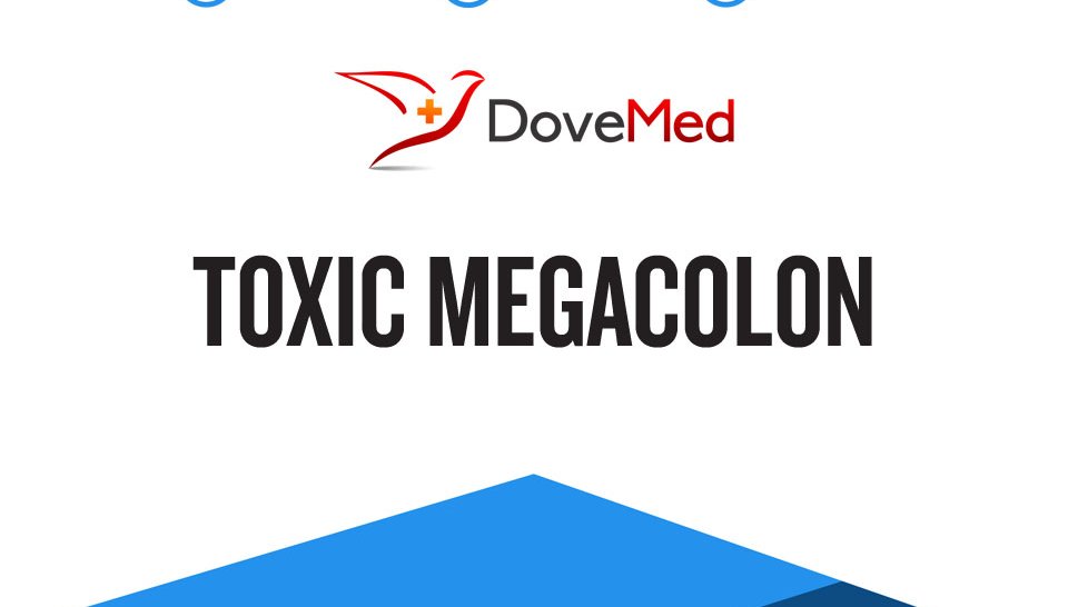 Toxic Megacolon