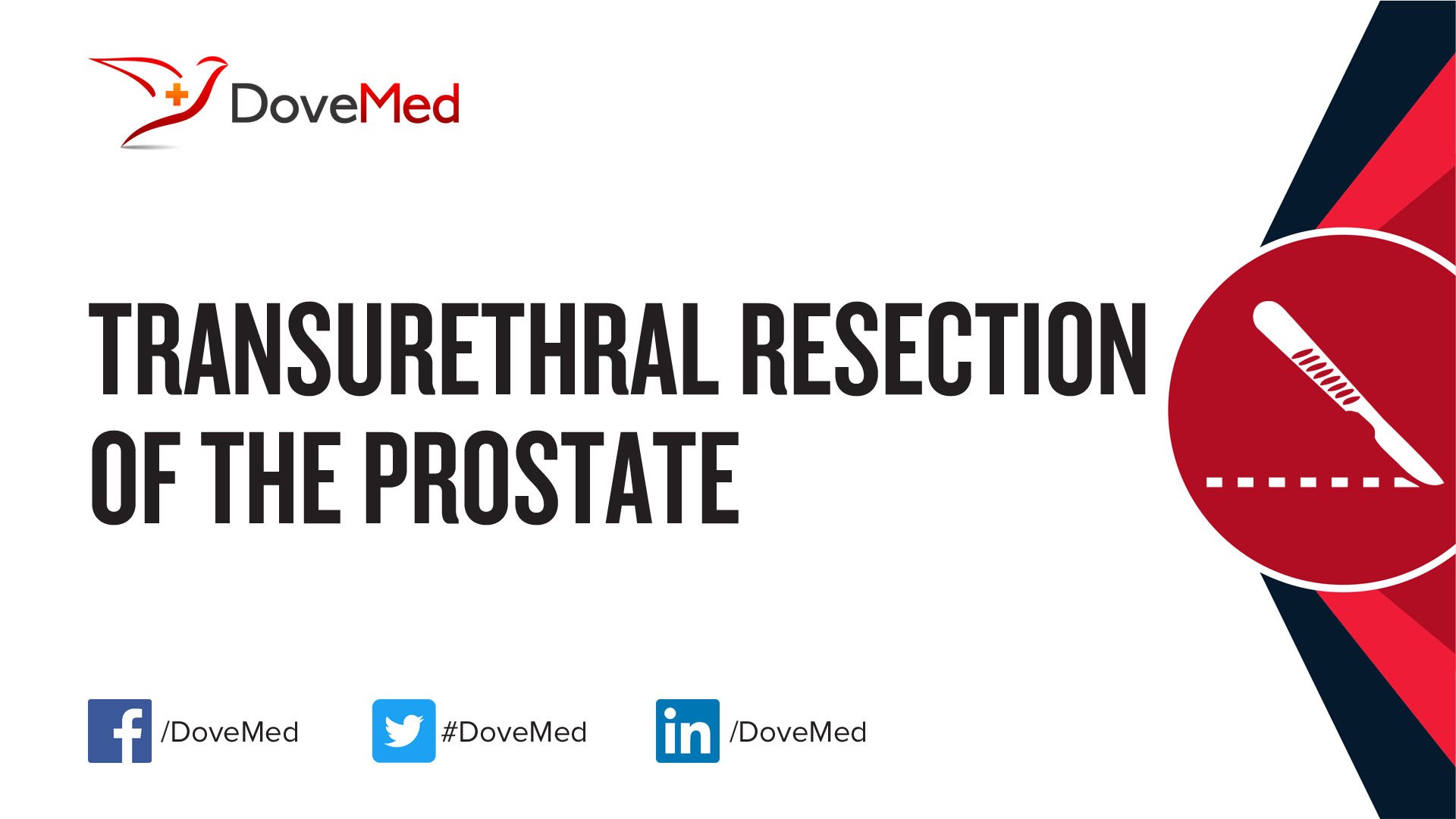 Transurethral Resection of the Prostate (TURP)