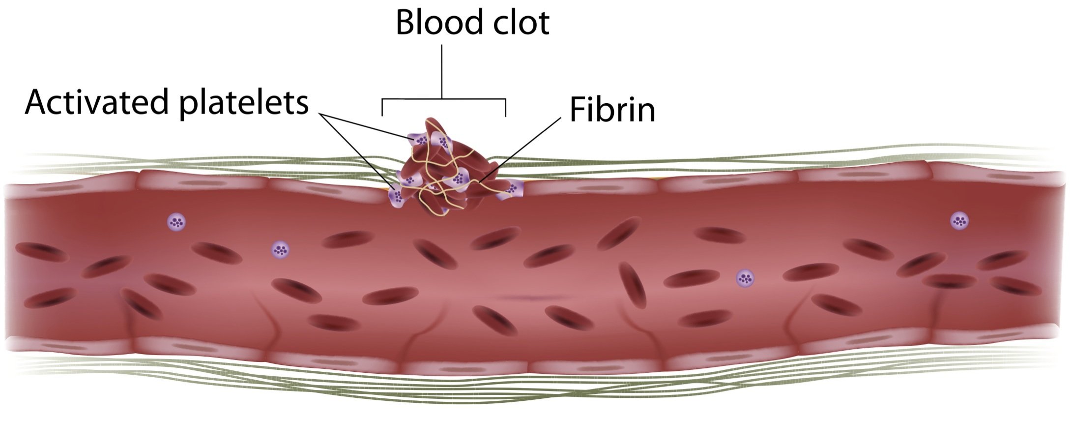 Coagulation Factors Blood Test
