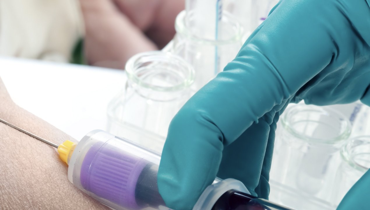 Measles and Mumps Blood Test