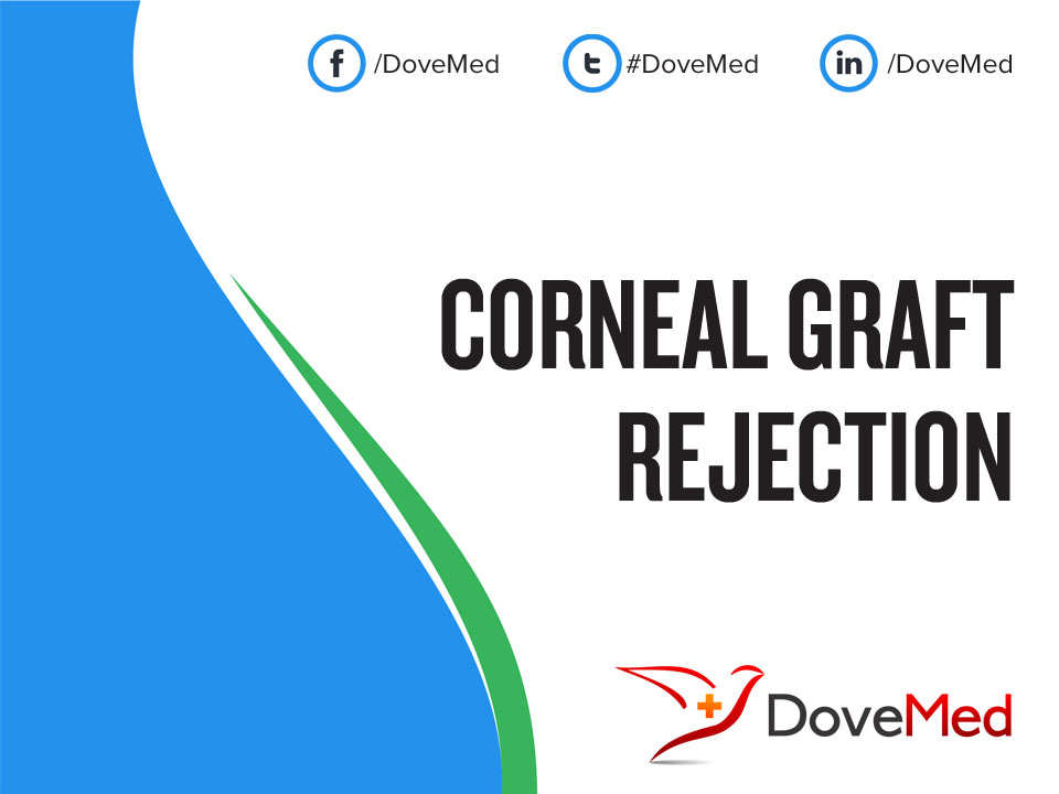 Corneal Transplant Rejection Treatment